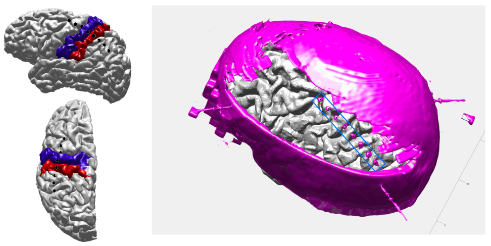 Figure 10. Workflow Depicting the Sequential Steps in ECoG Localization ...